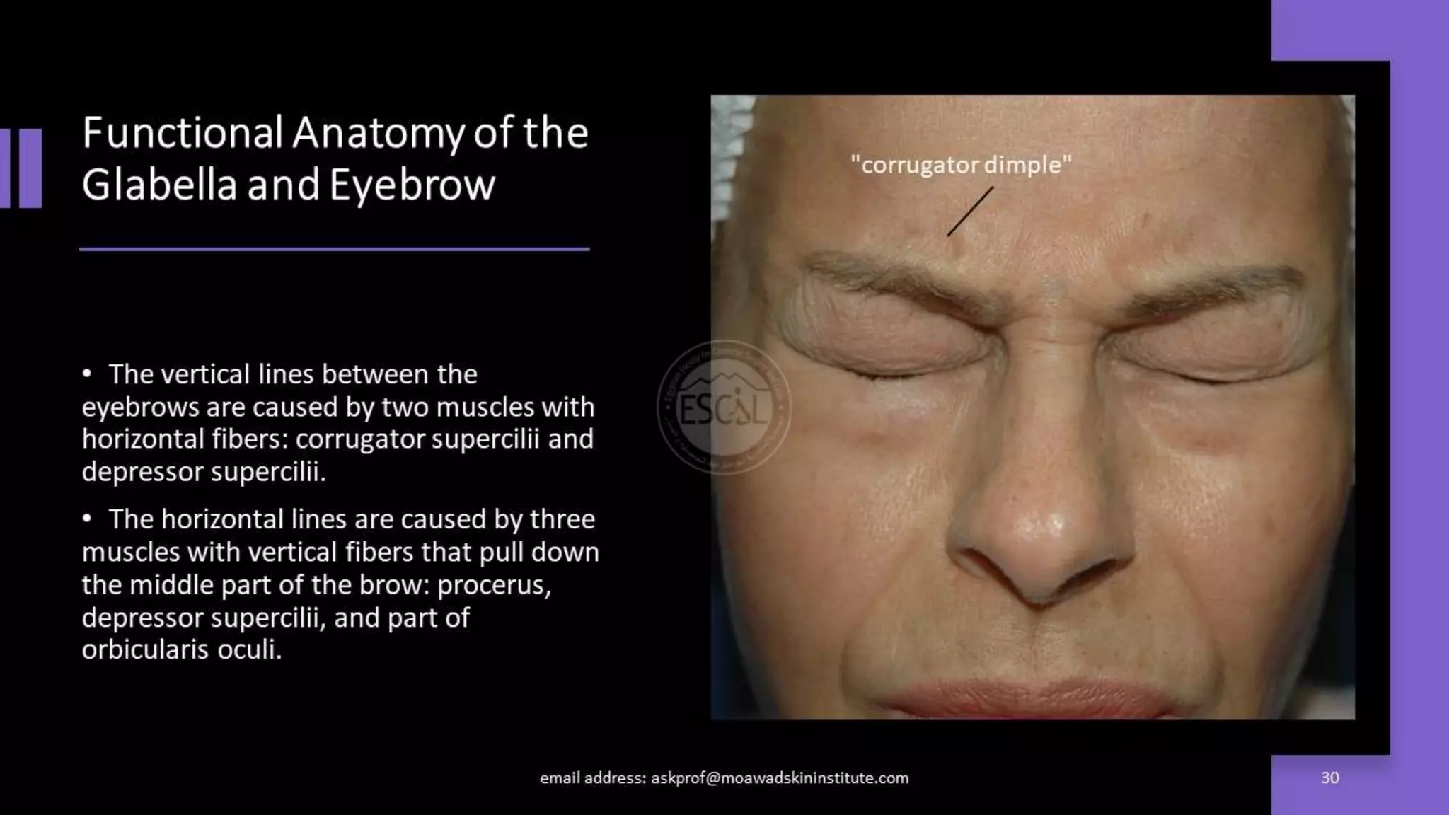Functional Anatomy of Facial Muscles. An Injector Eye. Part One.pptx