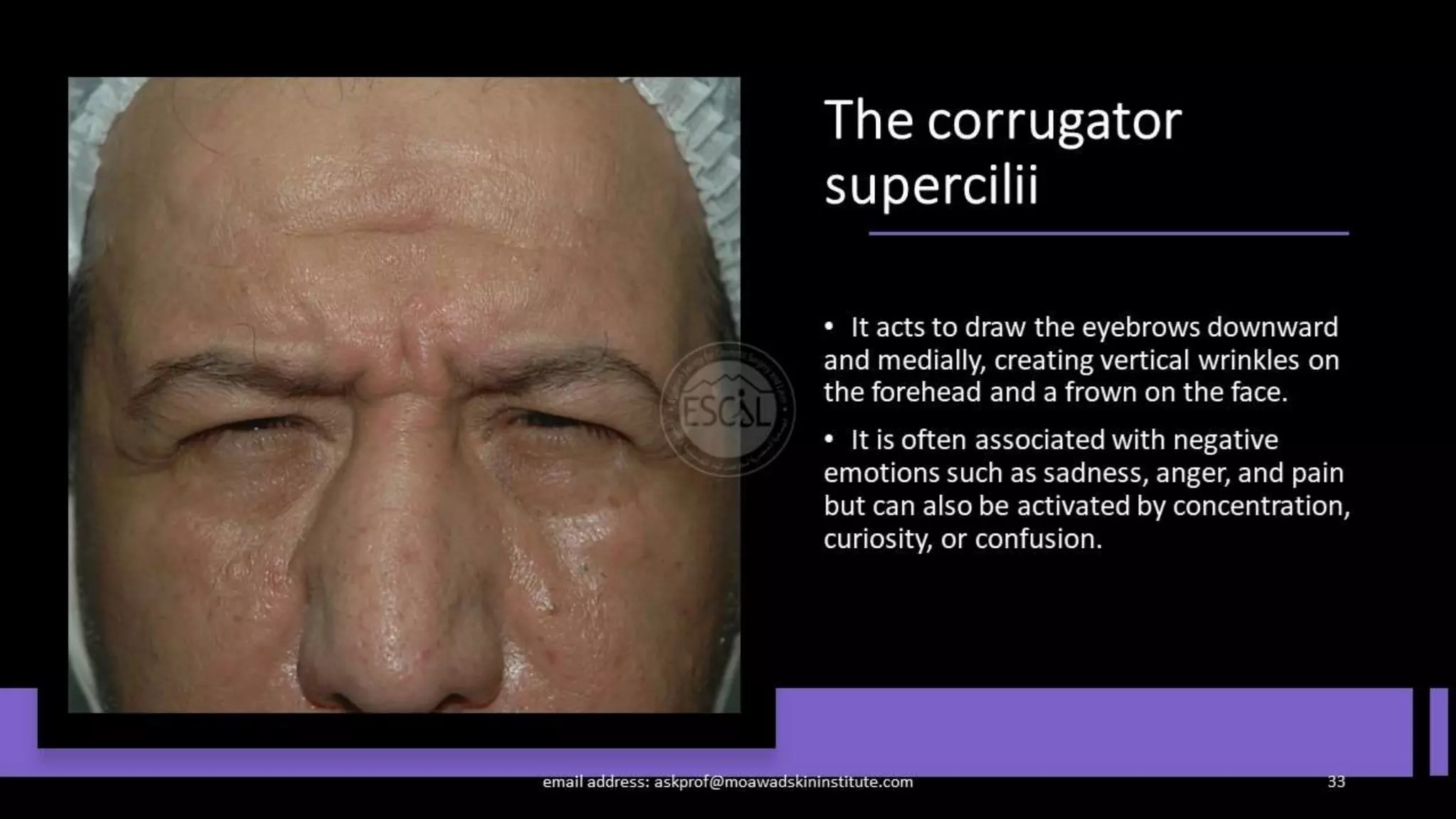 Functional Anatomy of Facial Muscles. An Injector Eye. Part One.pptx