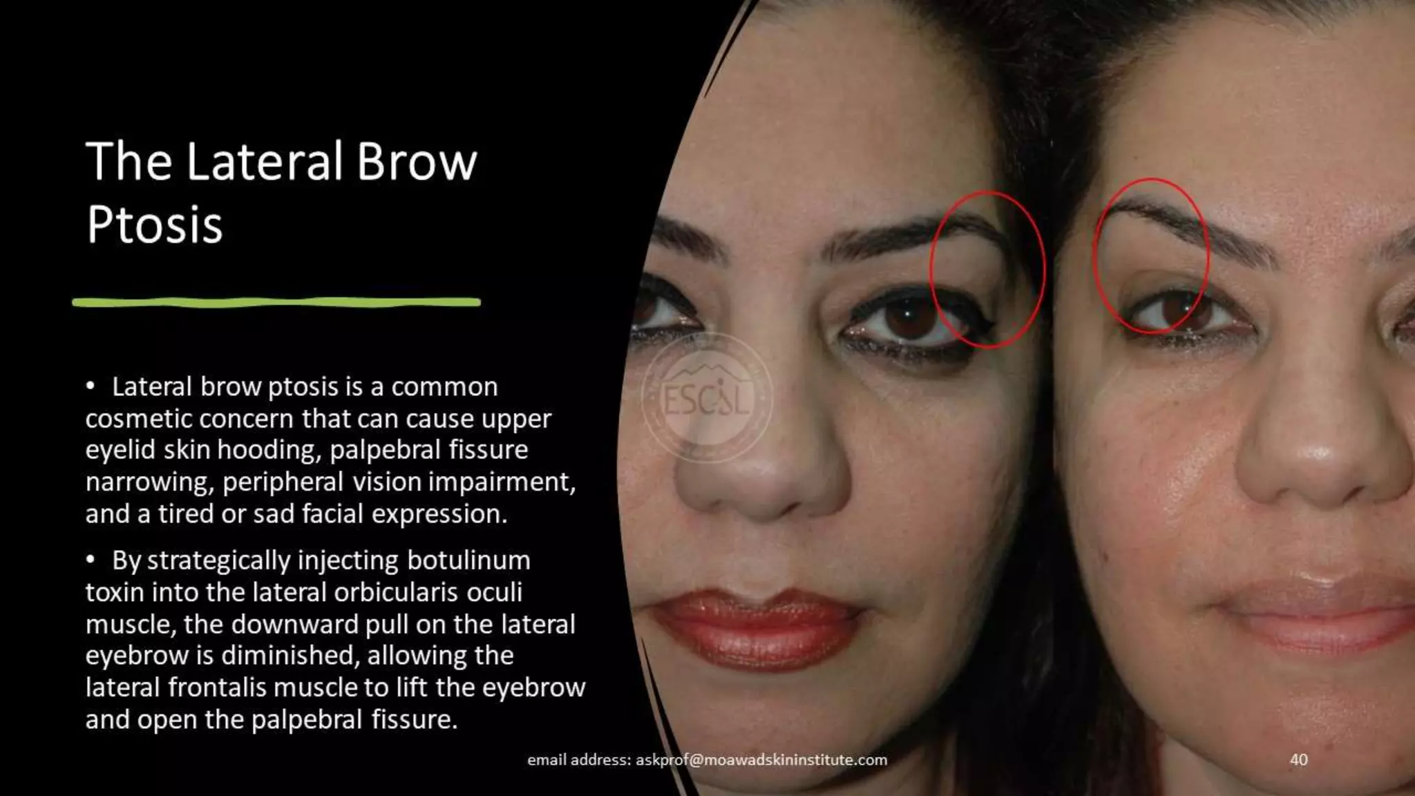 Functional Anatomy of Facial Muscles. An Injector Eye. Part One.pptx