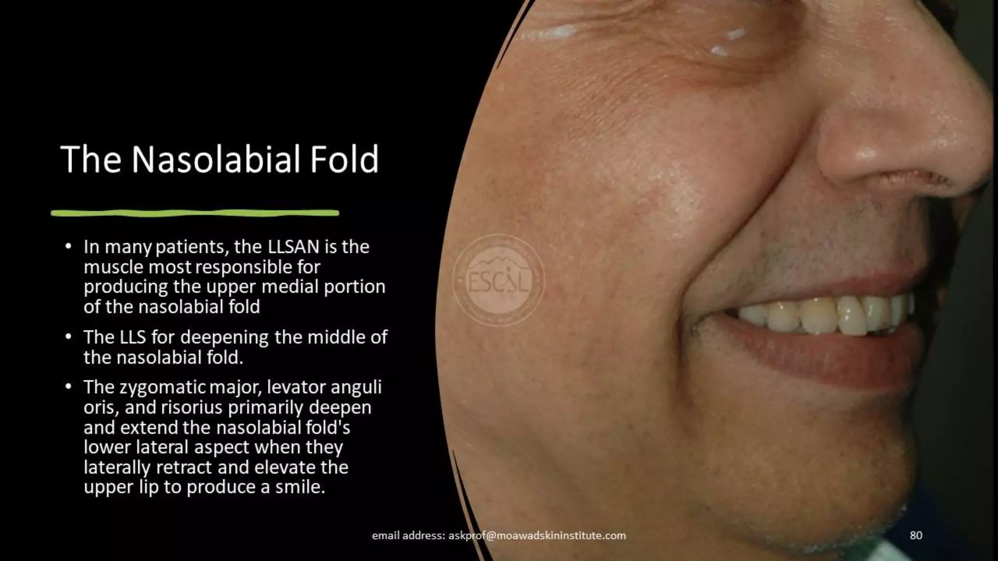 Functional Anatomy of Facial Muscles. An Injector Eye. Part Two.pptx