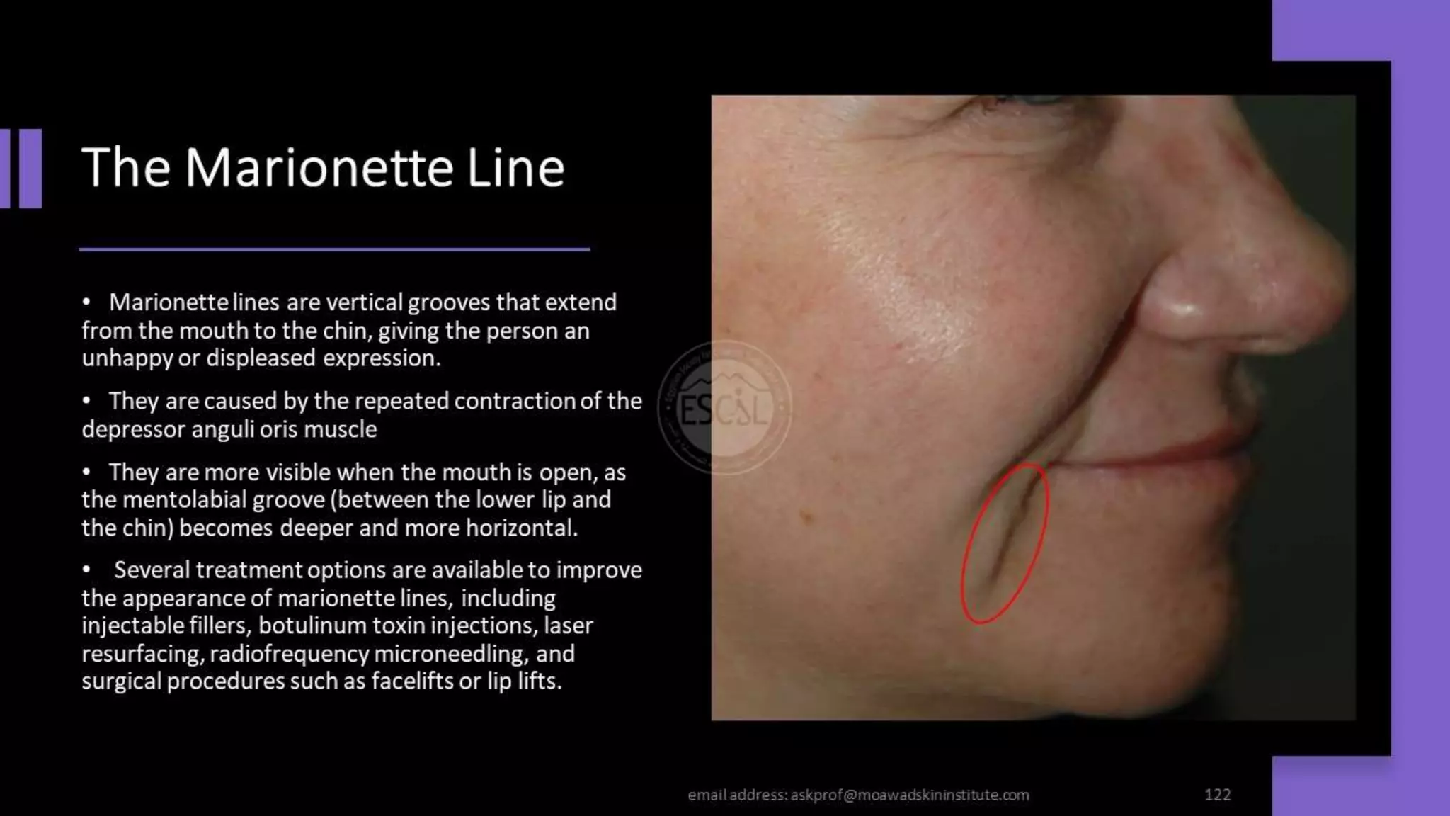 Functional Anatomy Of Facial Muscles An Injector Eye Part Twopptx