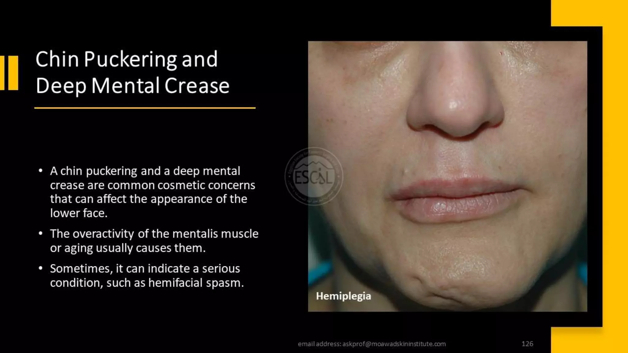 Functional Anatomy of Facial Muscles. An Injector Eye. Part Two.pptx