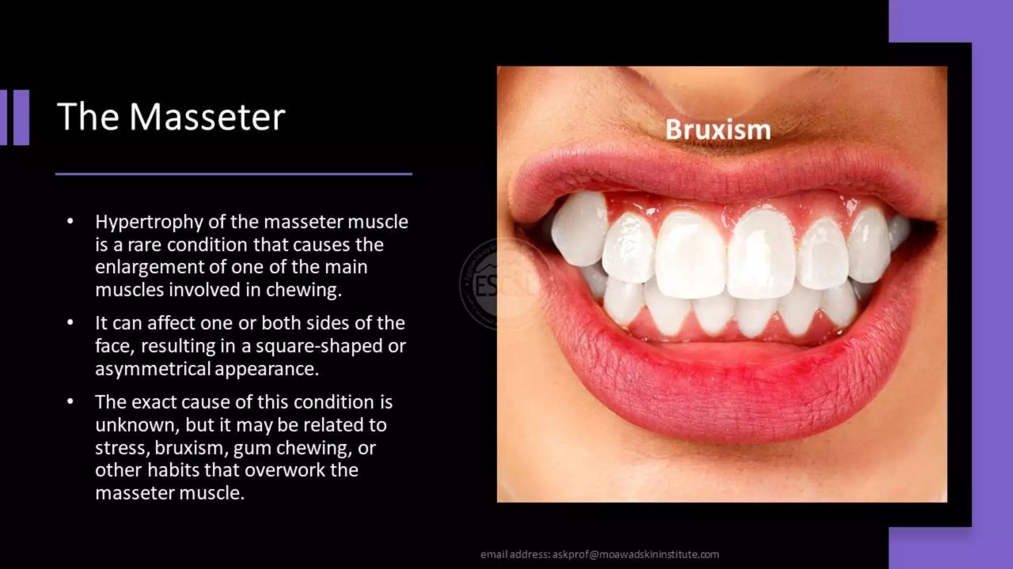 Functional Anatomy of Facial Muscles. An Injector Eye. Part Two.pptx