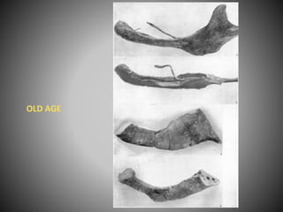 Functional anatomy of mandible | PPTX