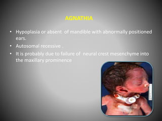 Functional anatomy of mandible | PPTX