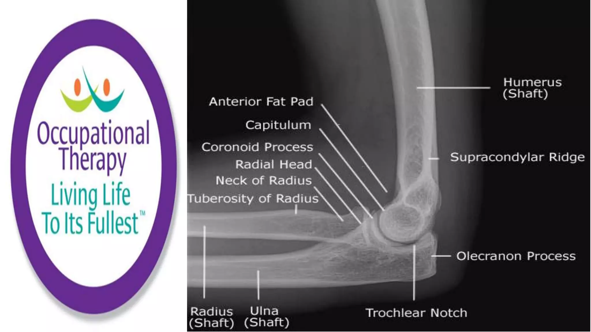 Functional Anatomy of the Elbow Joint | PPTX
