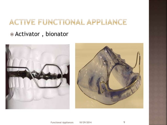 Functional appliances | PPTX | Dental Health | Diseases and Conditions