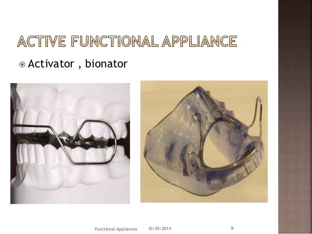 Functional appliances