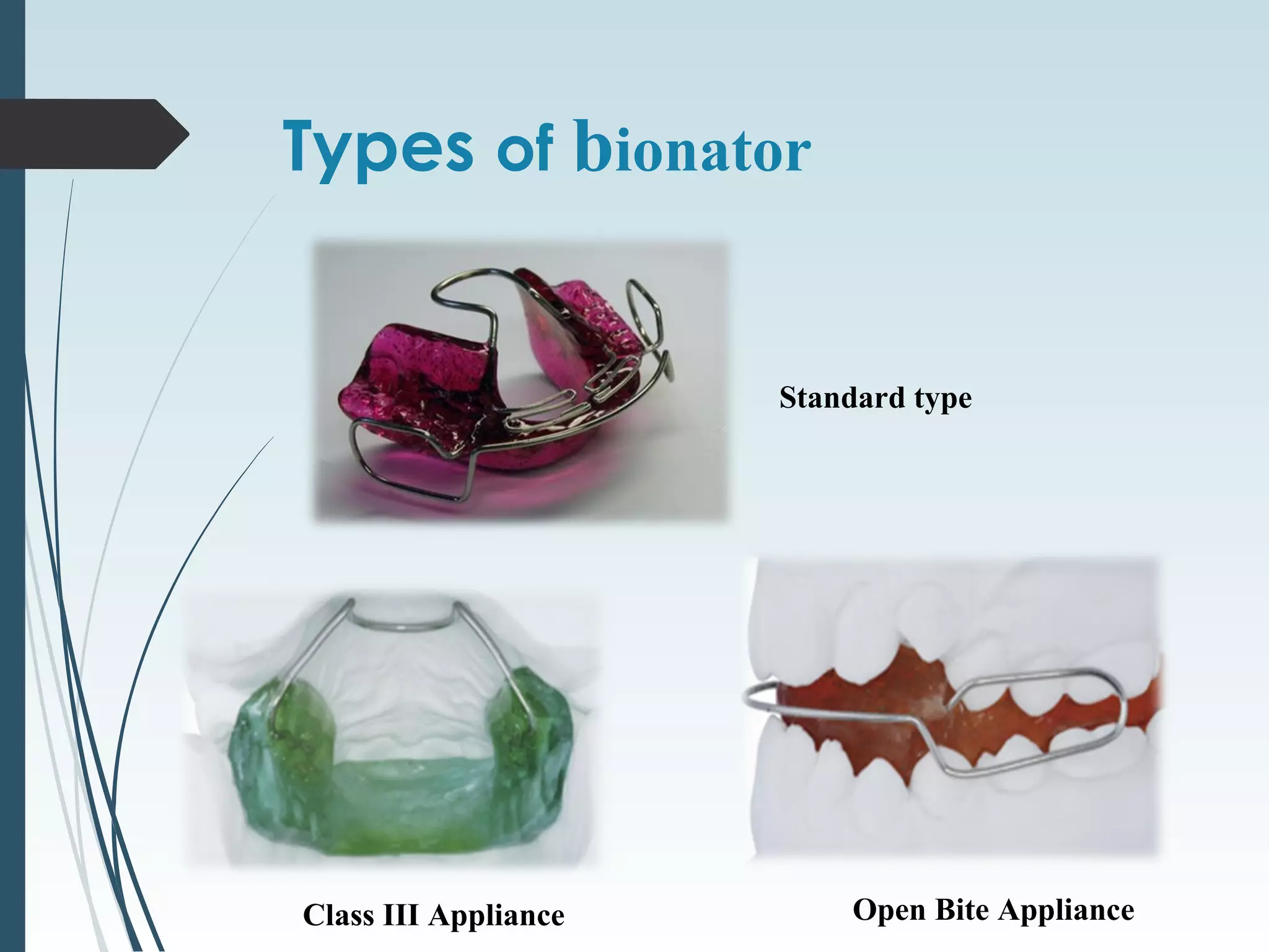 Functional appliances | PPT