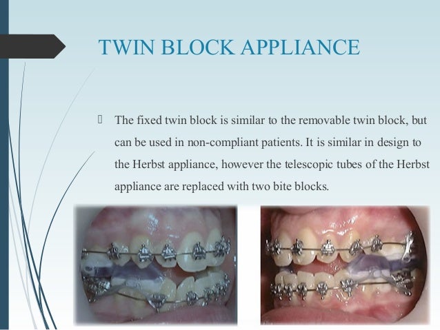 Functional appliances
