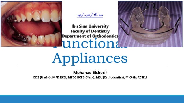 Functional appliances | PPTX