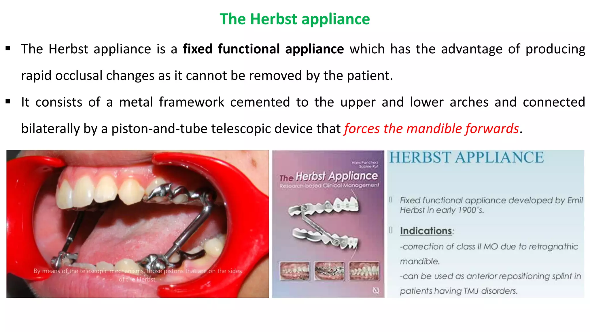 Functional appliances.pdf