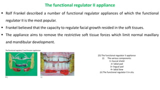 Functional appliances.pdf