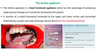 Functional appliances.pdf