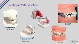 Functional appliances.pdf