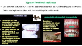 Functional appliances.pdf