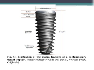Functional basis of dental implants | PPT