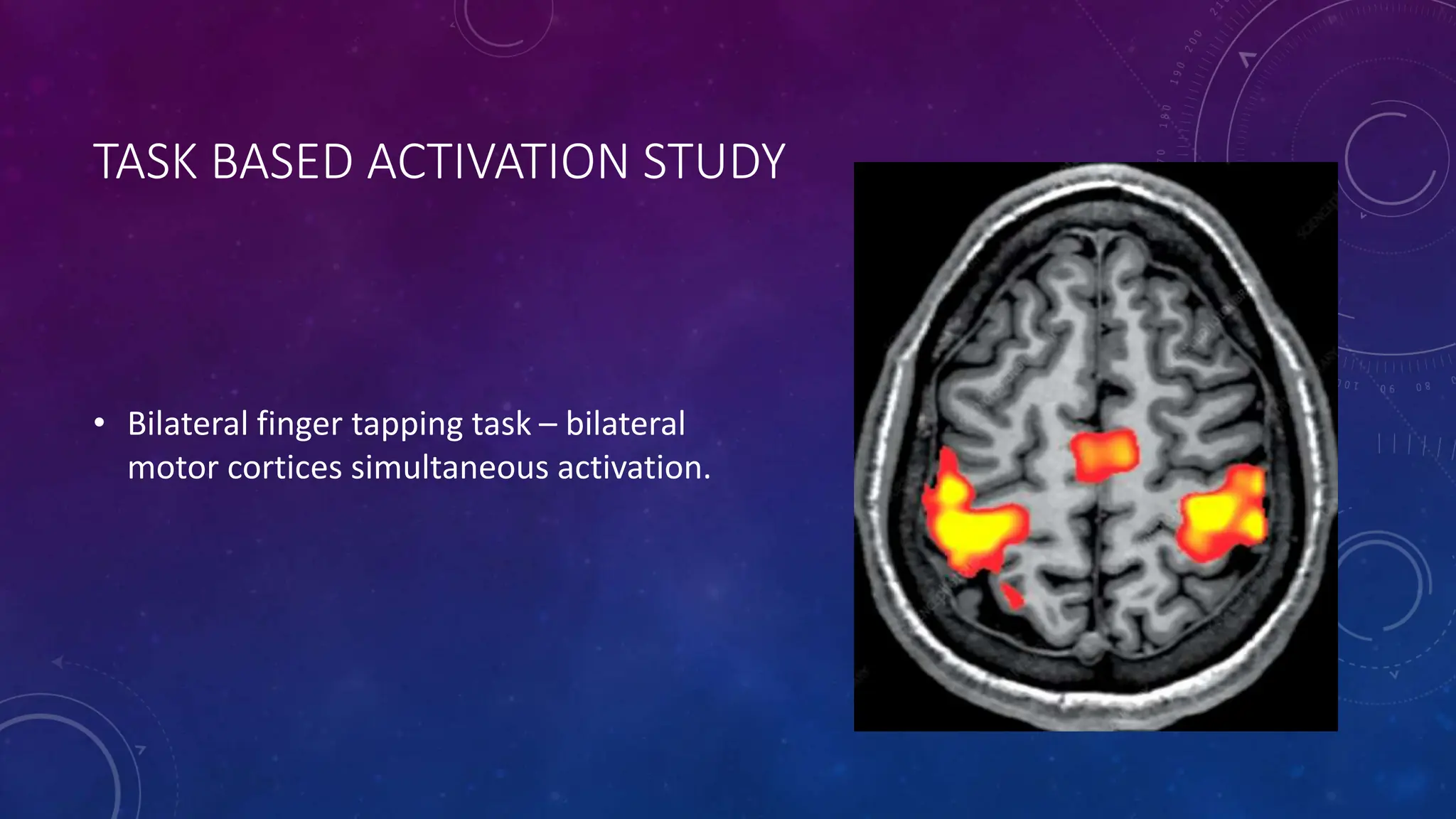 Functional Brain Default Mode Central Executive Network Pptx
