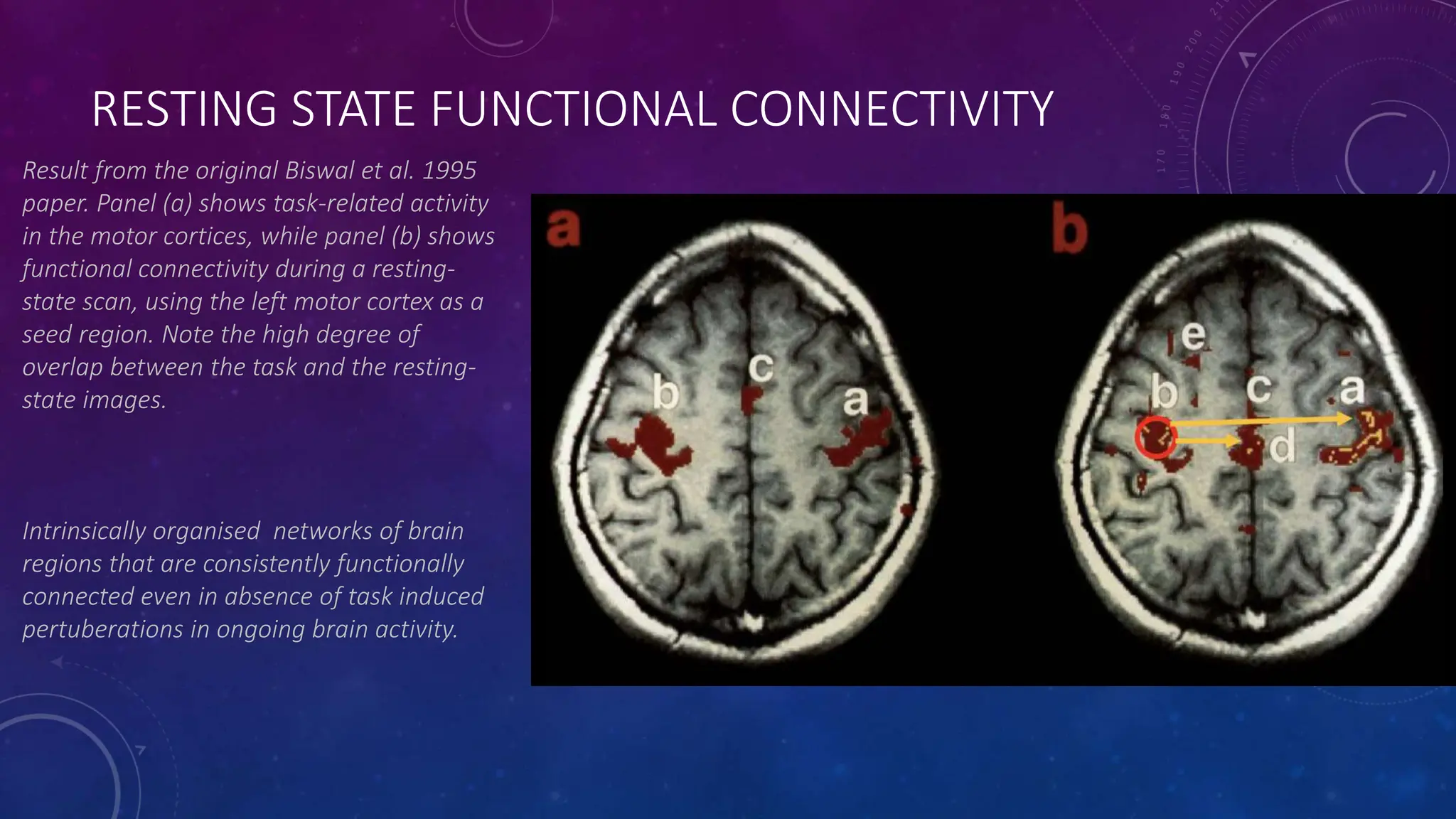 Functional Brain Default Mode Central Executive Network Pptx