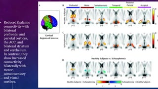 FUNCTIONAL BRAIN default mode, central executive network.pptx