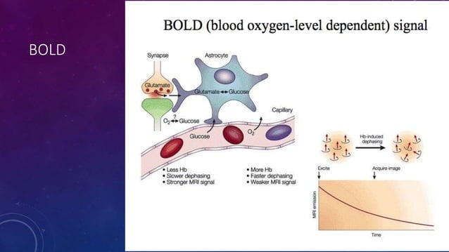 FUNCTIONAL BRAIN default mode, central executive network.pptx | Brain ...