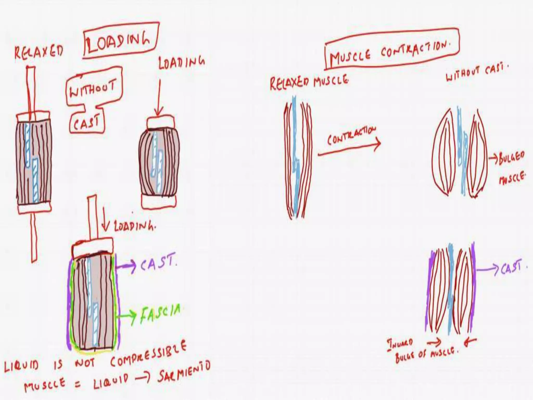 Functional cast bracing and various pop spica cast | PPTX