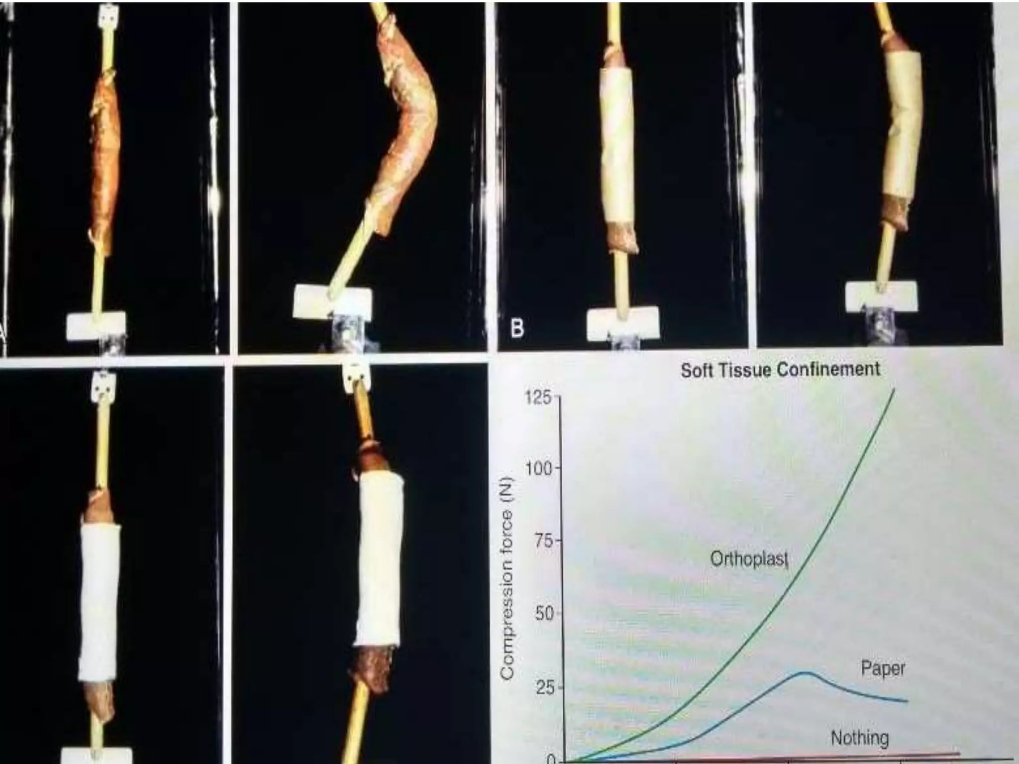 Functional cast bracing and various pop spica cast | PPTX
