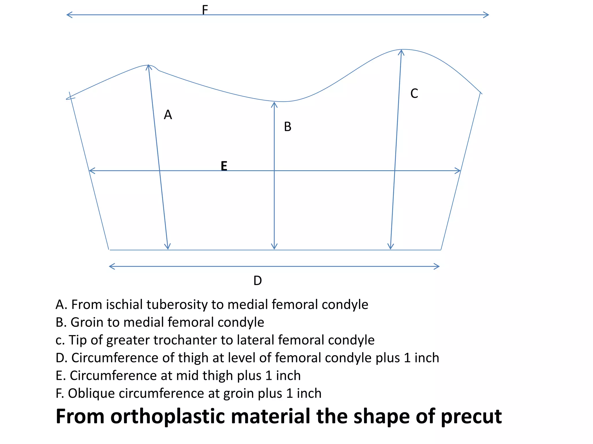 Functional cast bracing and various pop spica cast | PPTX