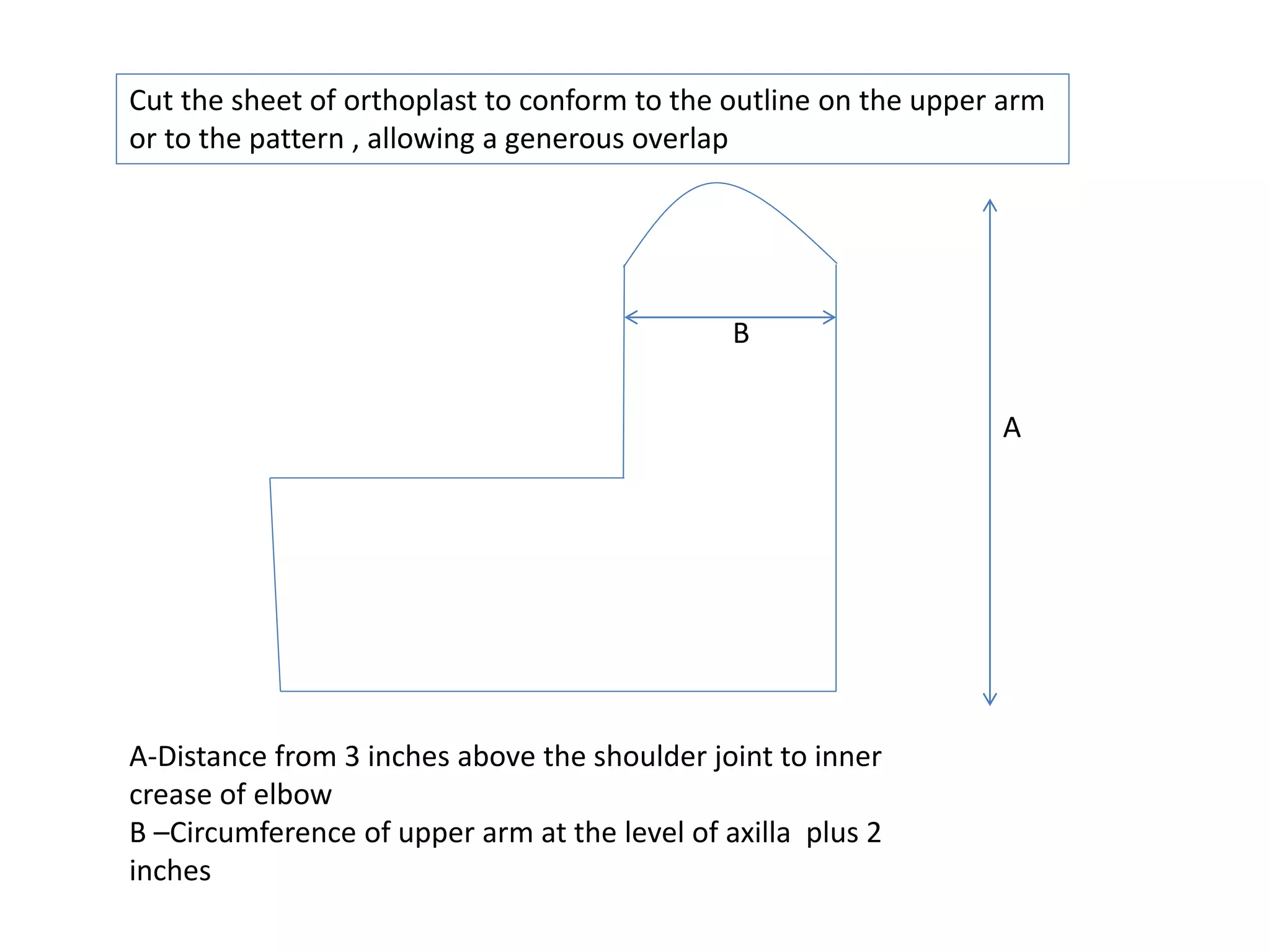 Functional cast bracing and various pop spica cast | PPTX