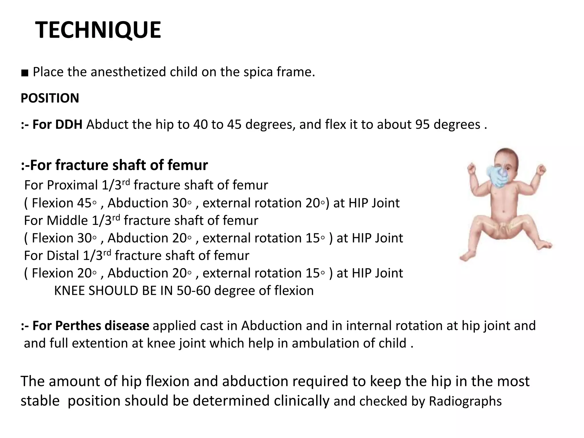 Functional cast bracing and various pop spica cast | PPTX