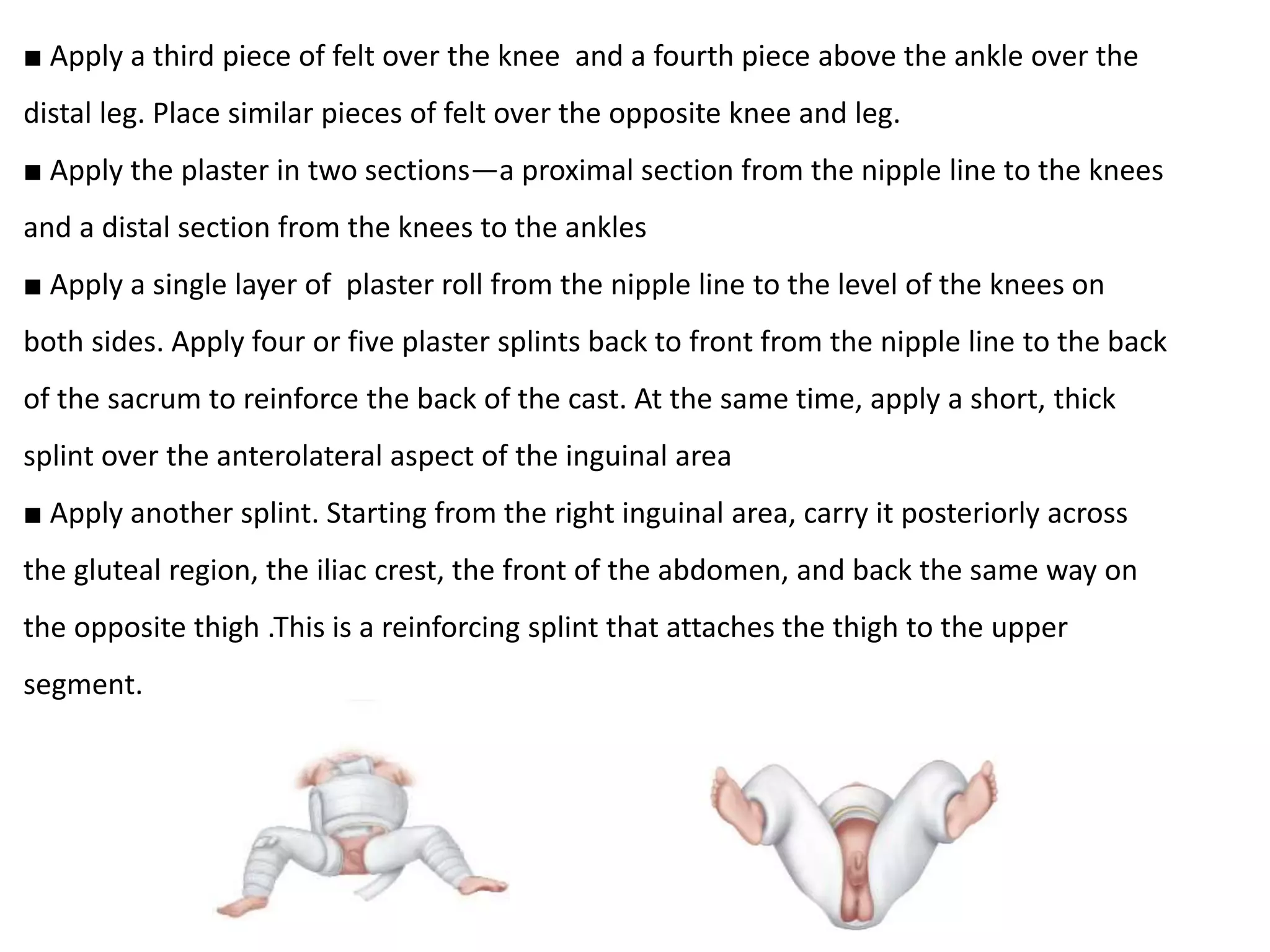 Functional cast bracing and various pop spica cast | PPTX