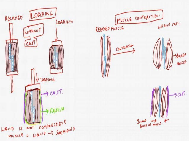 Functional cast bracing and various pop spica cast | PPTX | Death ...
