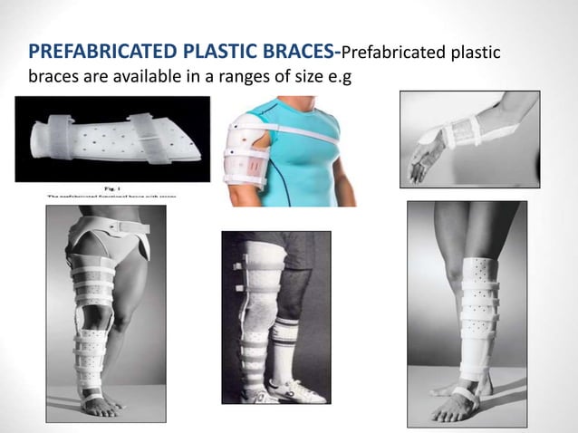 Functional cast bracing and various pop spica cast | PPTX | Death ...