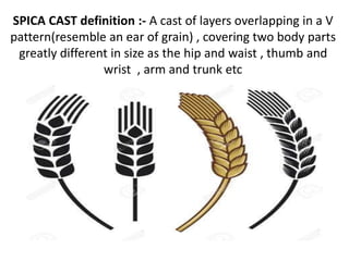 Functional cast bracing and various pop spica cast | PPTX