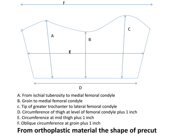 Functional cast bracing and various pop spica cast | PPTX | Death ...