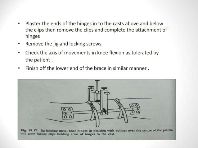 Functional cast bracing and various pop spica cast | PPTX | Death ...
