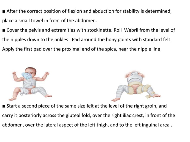 Functional cast bracing and various pop spica cast | PPTX | Death ...