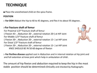 Double Hip Spica Cast