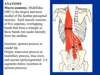 Multifidus Triangle Syndrome
