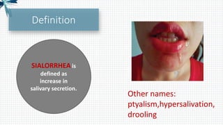 Functional disorders of_salivary_glands | PPTX | Ear, Nose and Throat ...