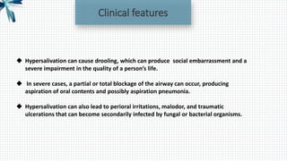 Functional disorders of_salivary_glands | PPTX