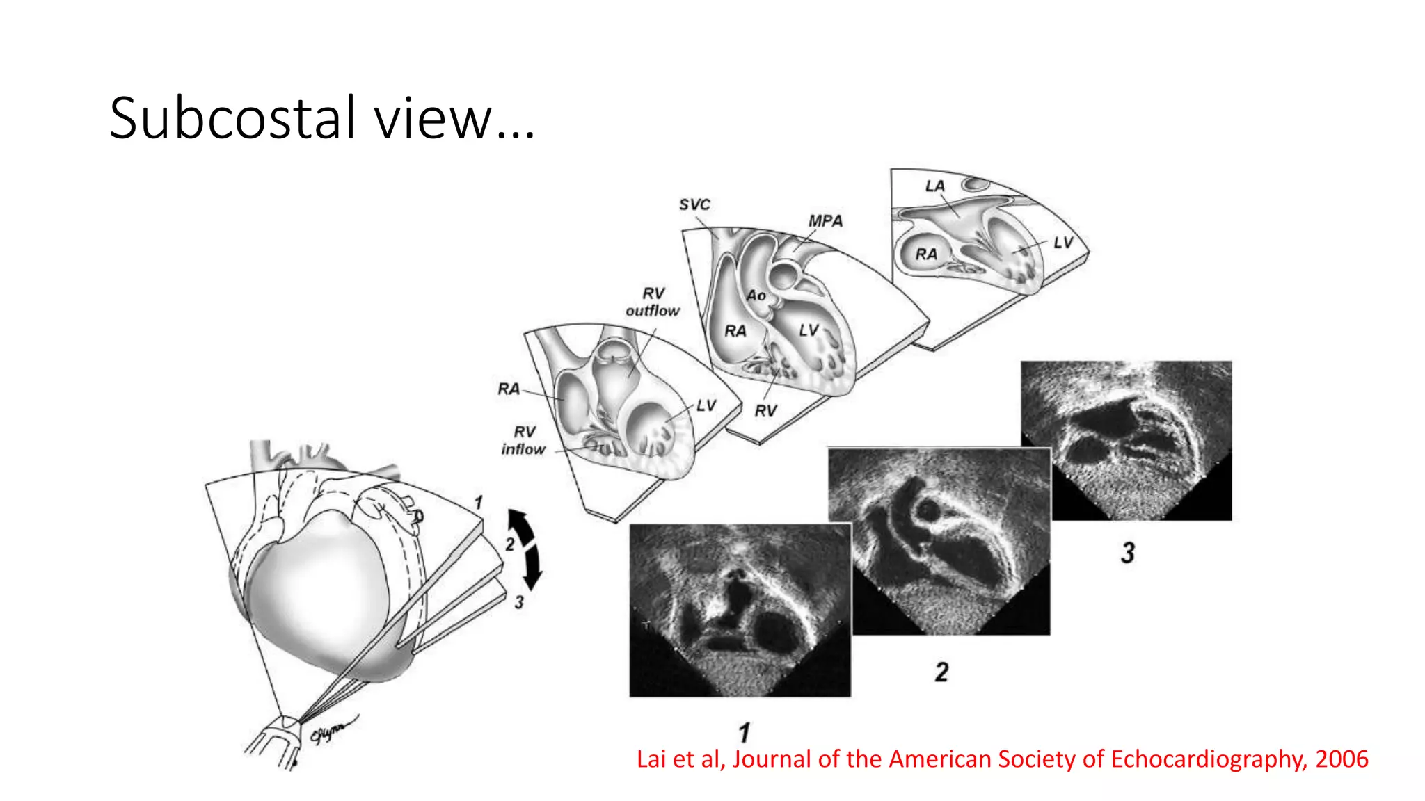 Functional ECHO.pptx