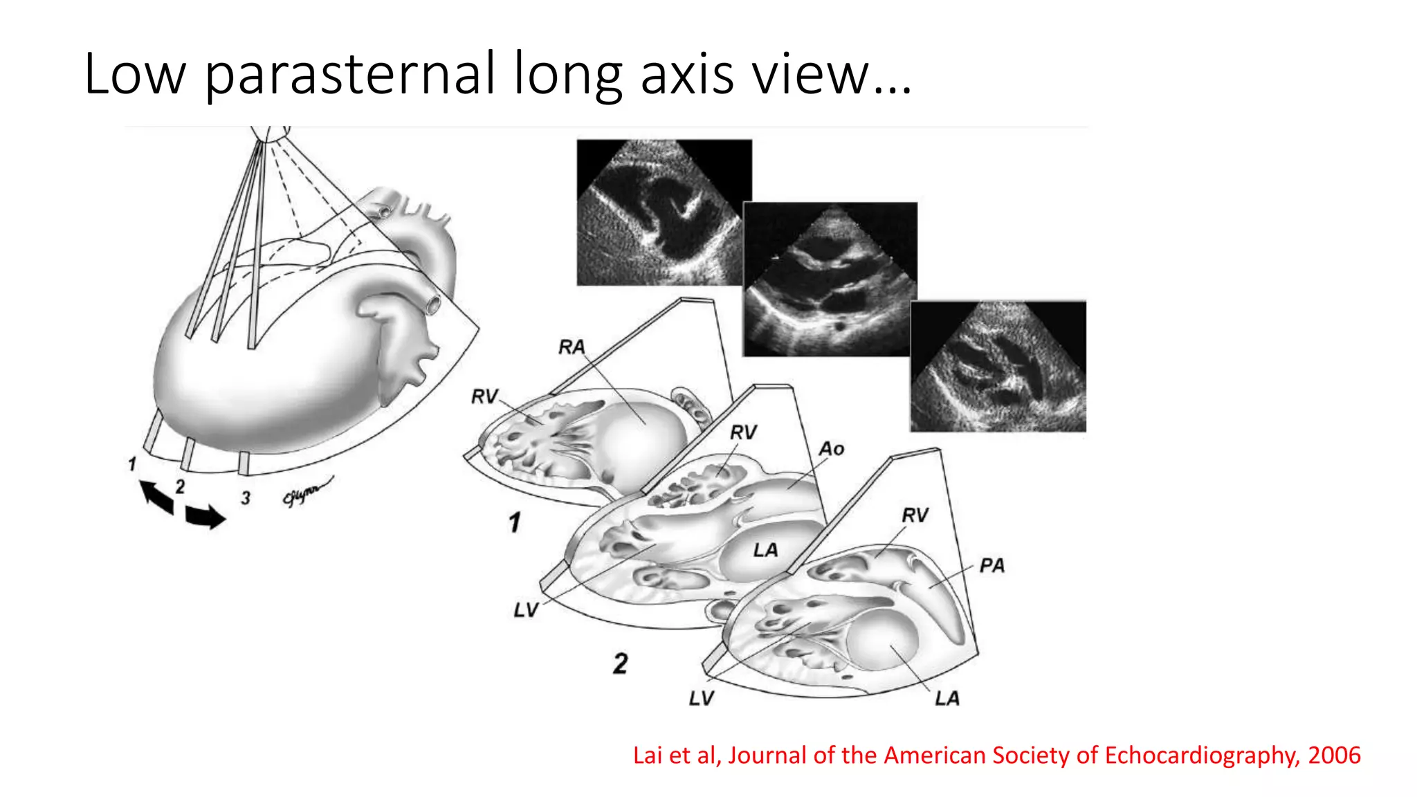 Functional ECHO.pptx
