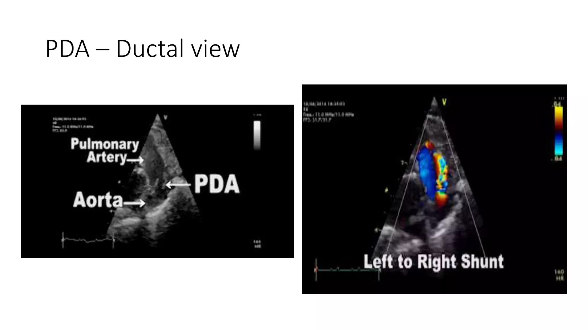 Functional ECHO.pptx
