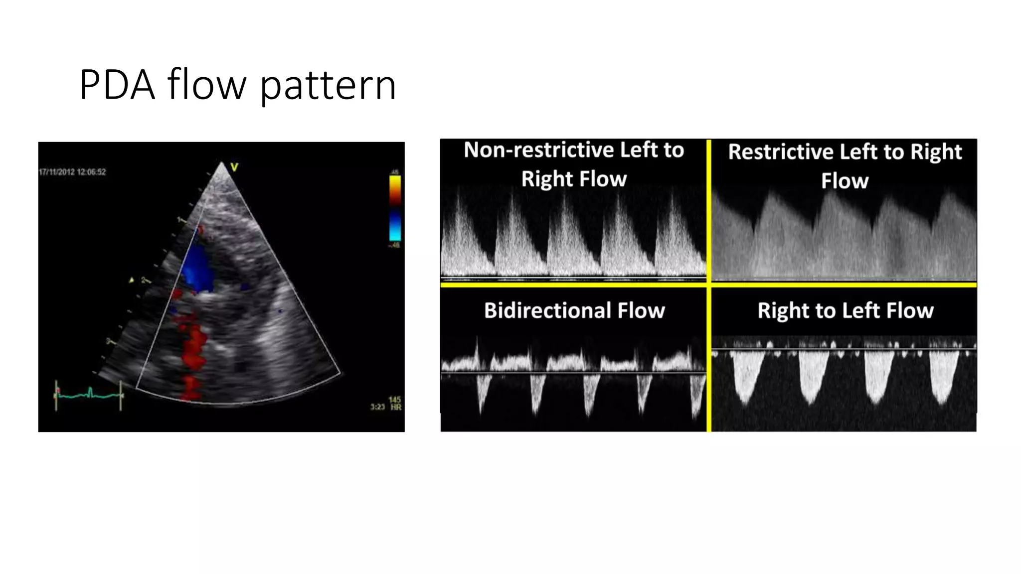 Functional ECHO.pptx