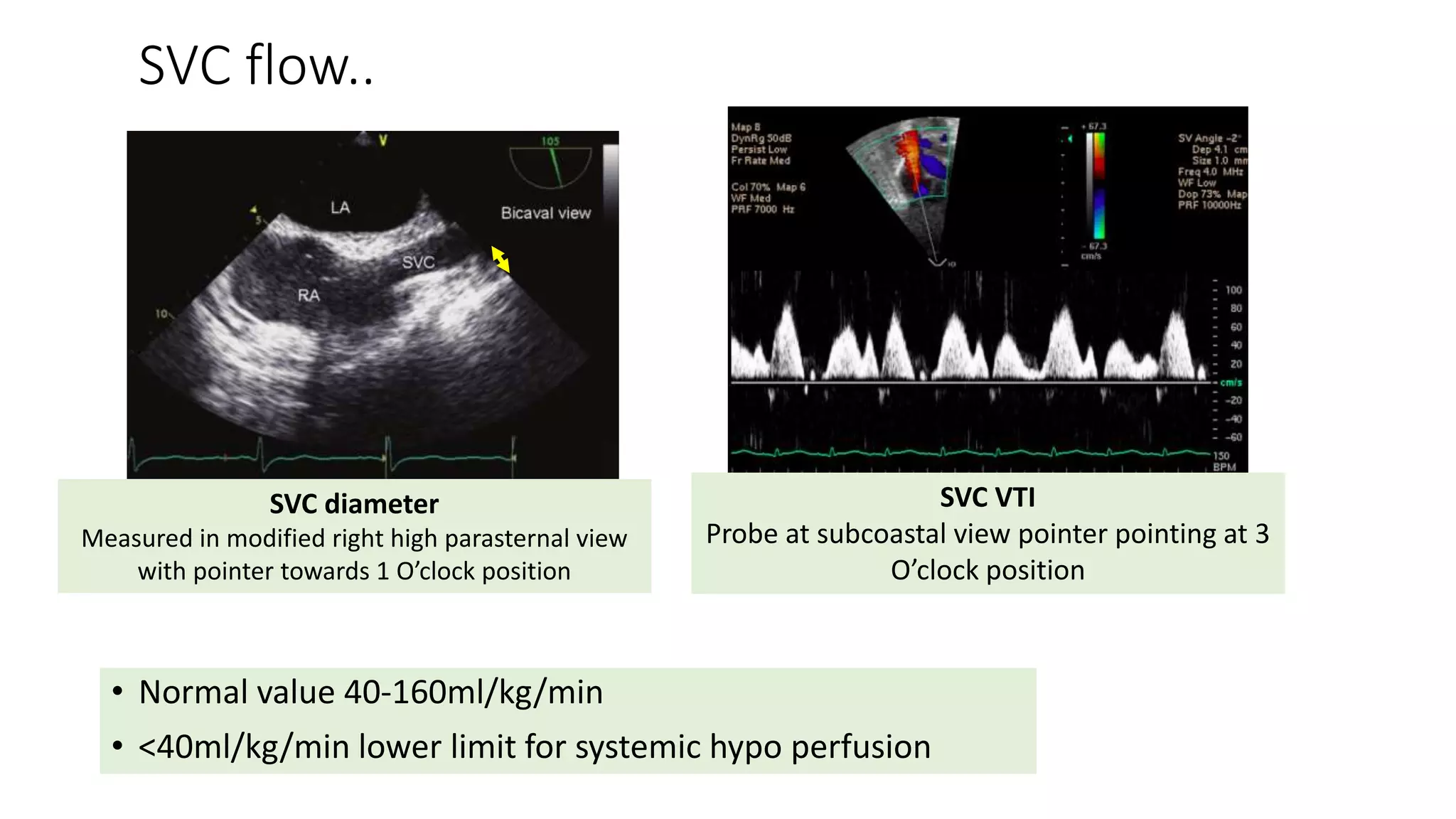 Functional ECHO.pptx
