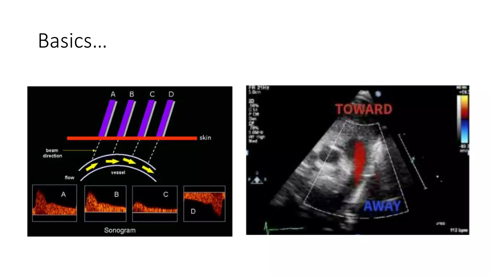 Functional ECHO.pptx