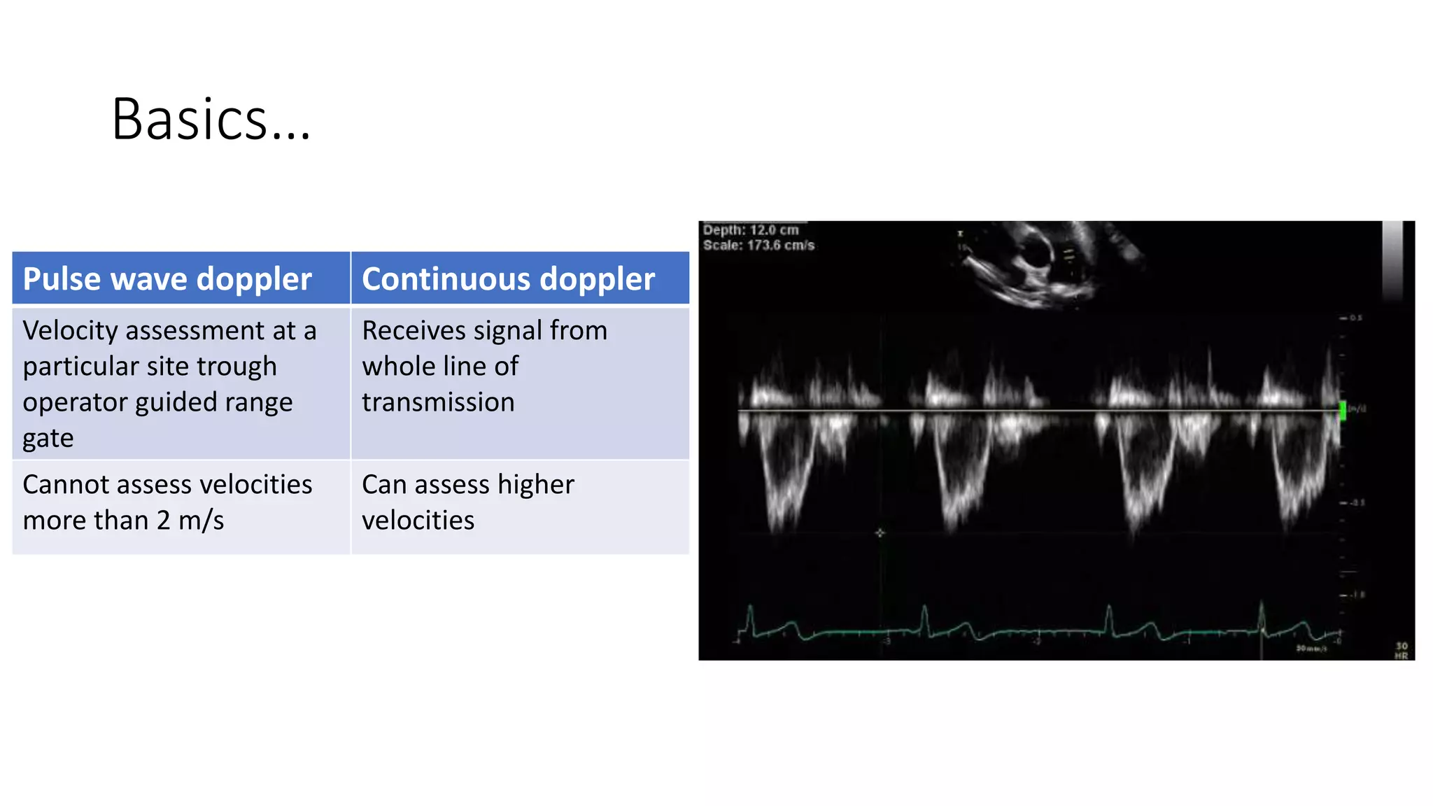 Functional ECHO.pptx
