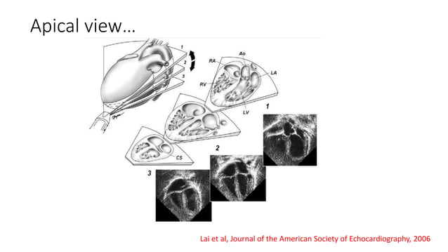 Functional ECHO.pptx