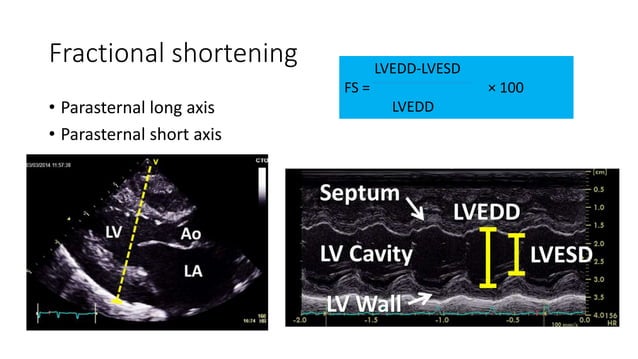 Functional ECHO.pptx
